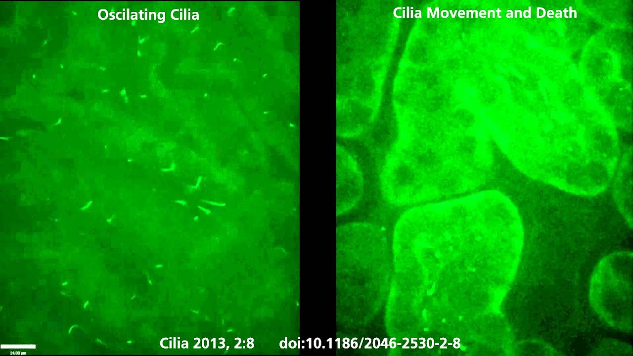 An inducible CiliaGFP mouse model for in vivo visualization and ...