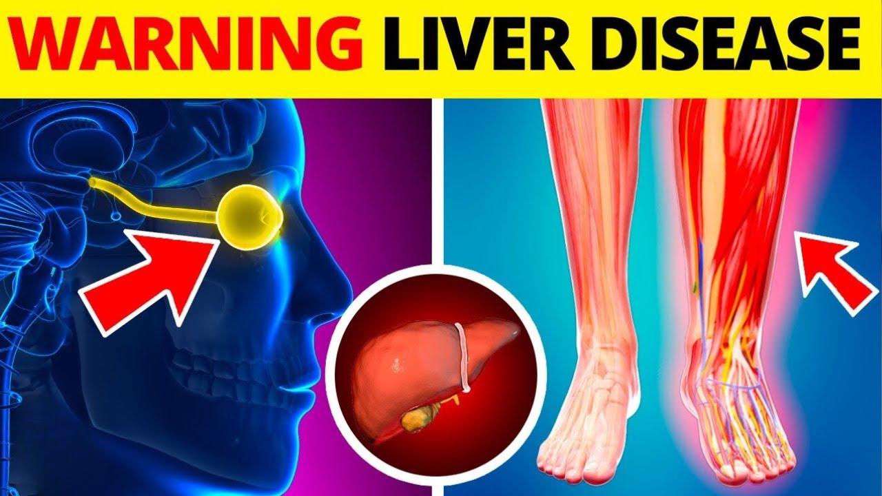 How Your Feet Are Warning You About Your Liver Problems - YouTube