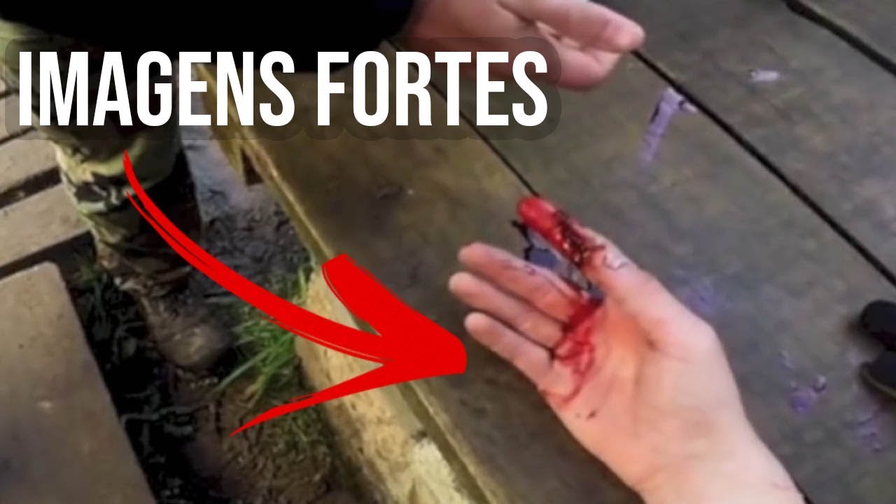 ACIDENTES MAIS GRAVES NO AIRSOFT 🤮 PERDEU O DEDO - YouTube