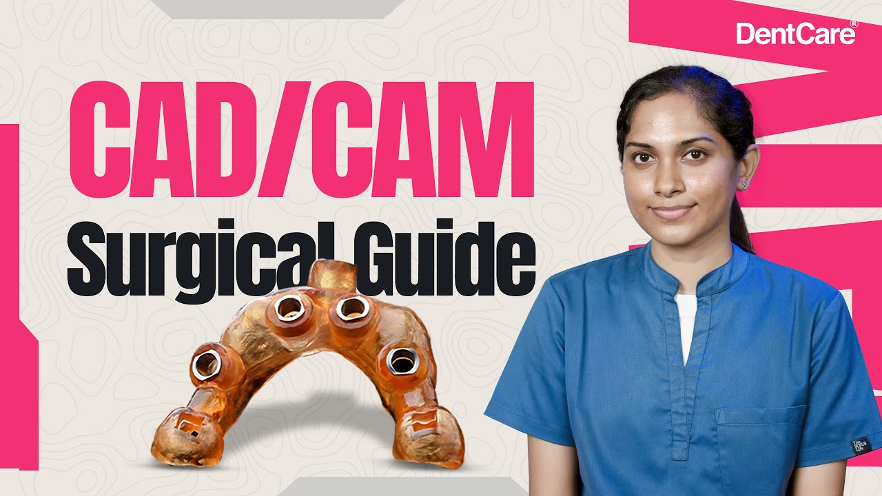 Surgical Guides for Precise and Predictable Implant Placement | DUAL ...