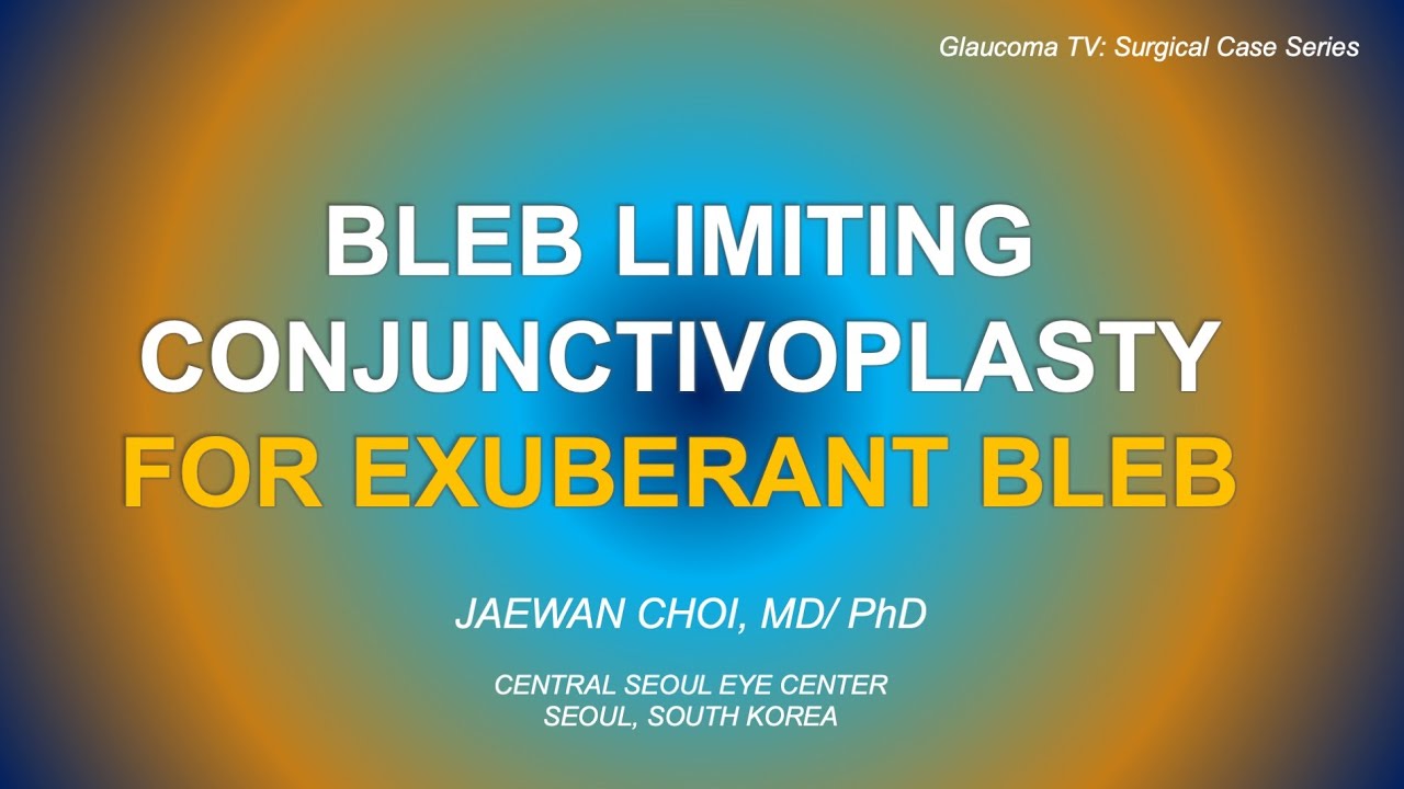 Bleb limiting conjunctivoplasty for exuberant bleb following ...