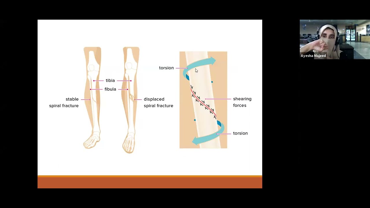 Biomechanics 2 | LECTURE 10 | Ergonomics - YouTube