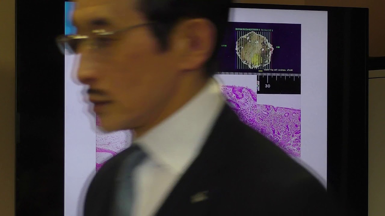 03 Toru Ito Недифференцированная аденокарцинома Эндоскопическая ...