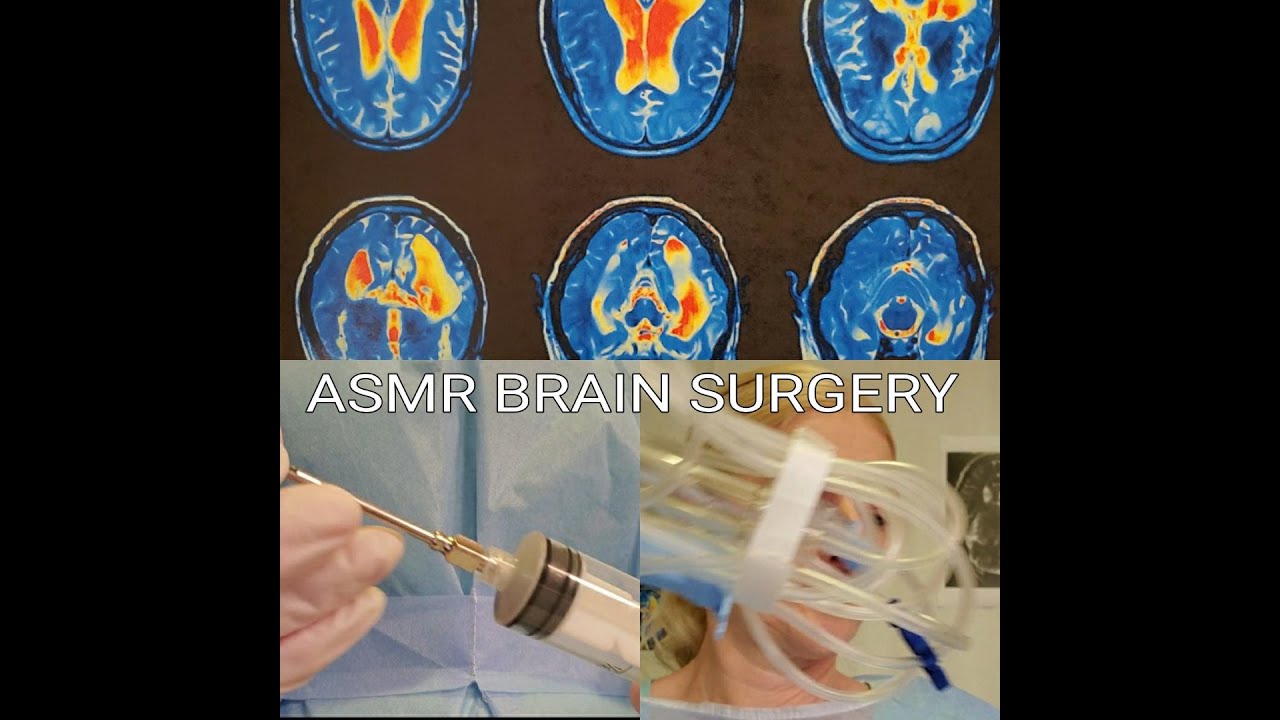 ASMR MEDICAL BRAIN SURGERY Anesthesia [REAL MEDICAL TOOLS]Doctor ...