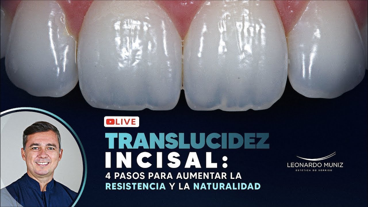 Translucidez Incisal: 4 Pasos para Aumentar la Resistencia y la ...