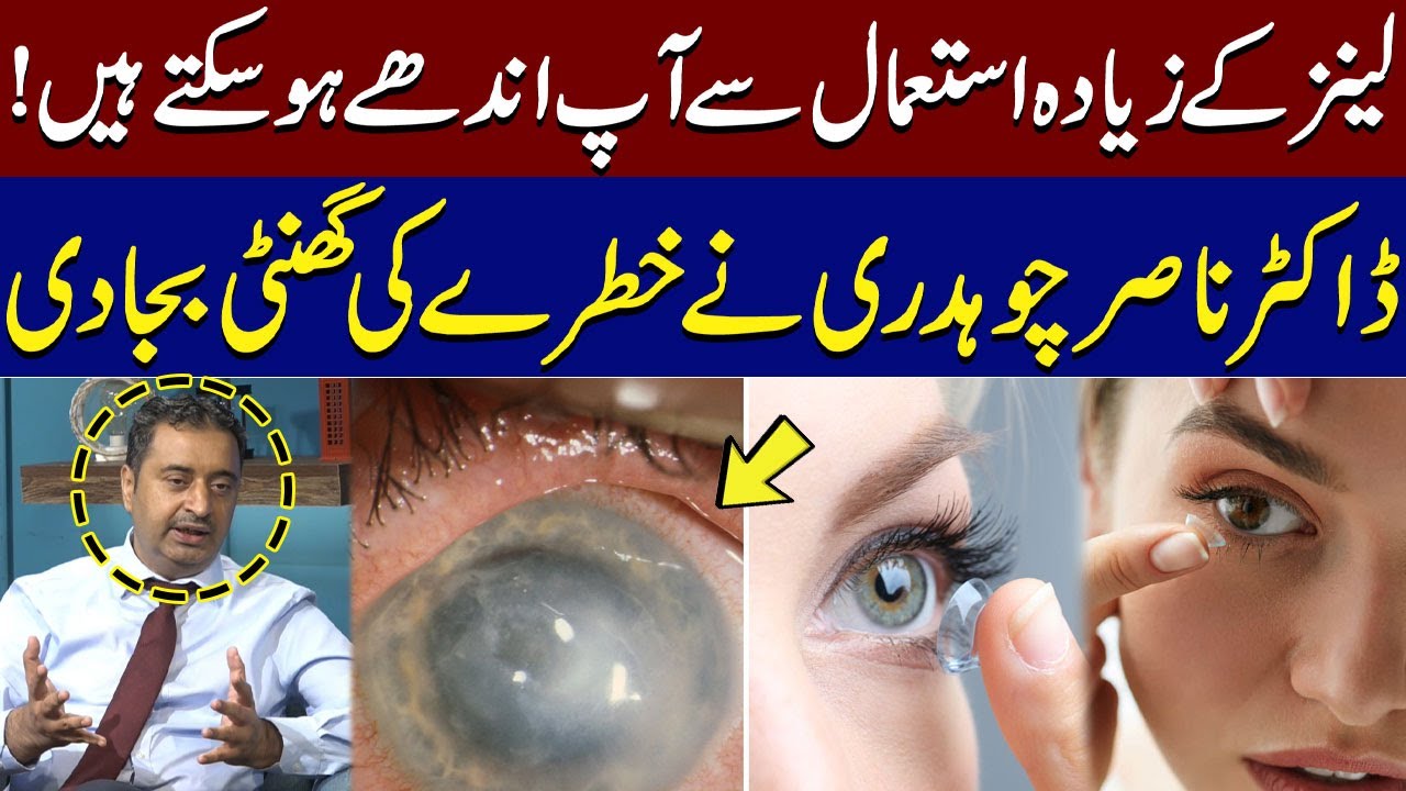 Overuse Of Contact Lenses Will Lead To Blindness? | Health Talk | SAMAA ...