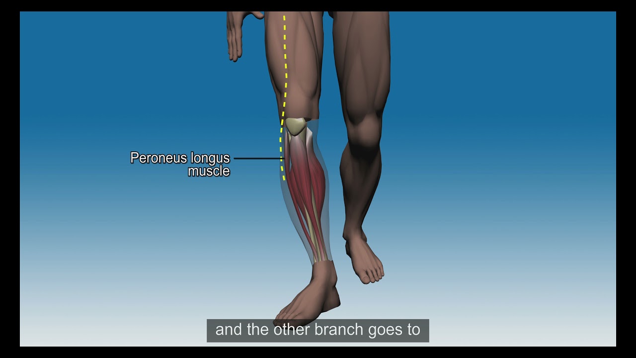 How FES lifts the foot - YouTube