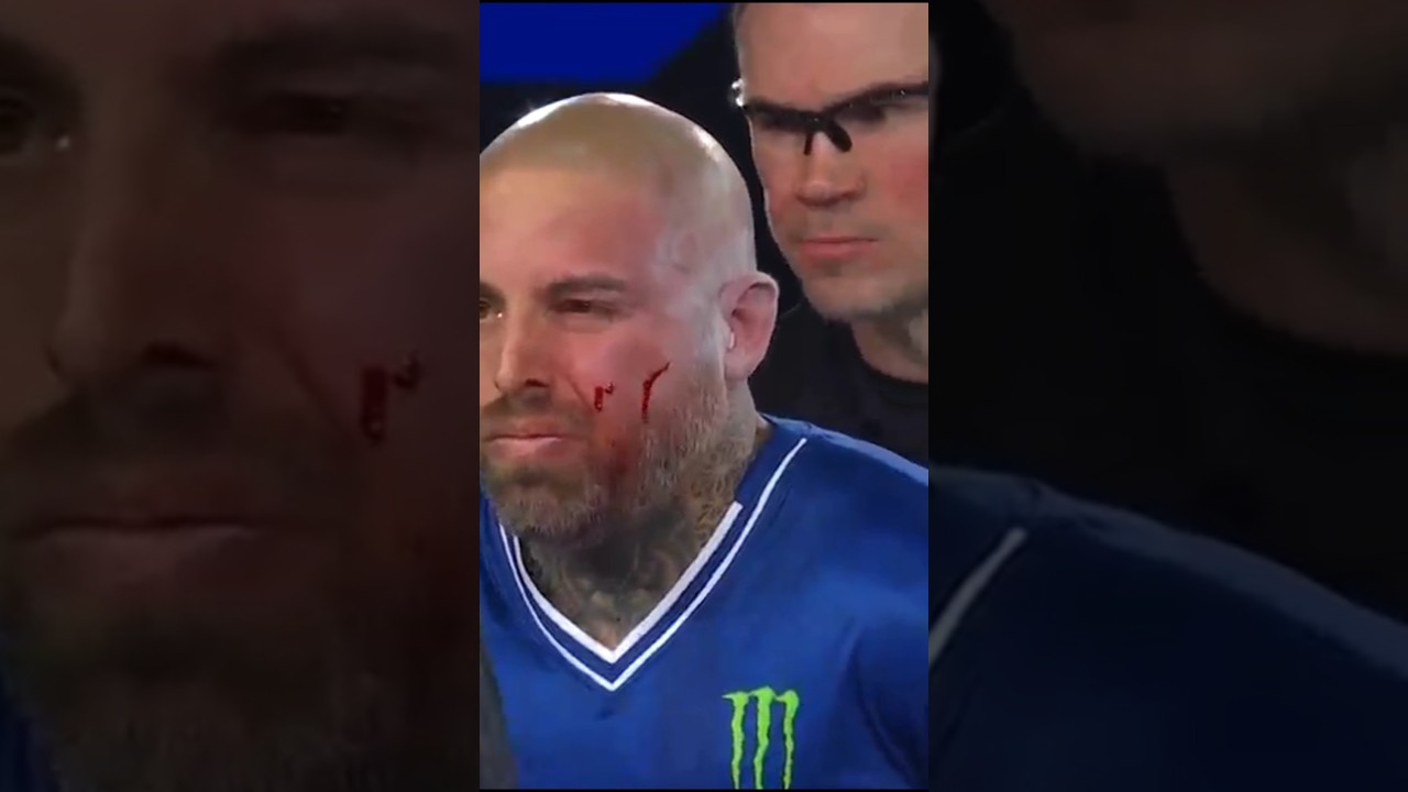 Slap Contest HARDEST HITS 💪🏽 😳 🤕 #slapcontest #slapboxing #stacksempire ...