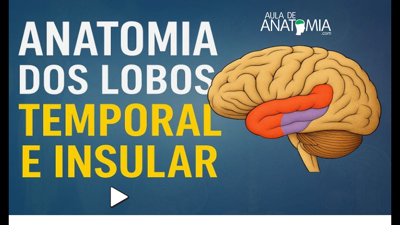 Lobo Insular Resection Of A Giant Insular Glioma In The Dominant