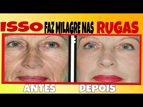 ANTI RUGAS NATURAL COMO ELIMINAR RUGAS DO ROSTO USE 1 SEMANA ESTA ...