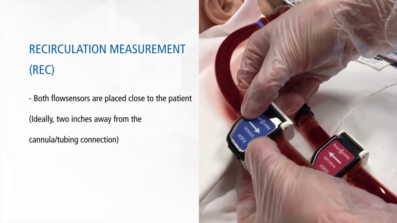 ELSA Monitor - Flowsensor Placement - YouTube
