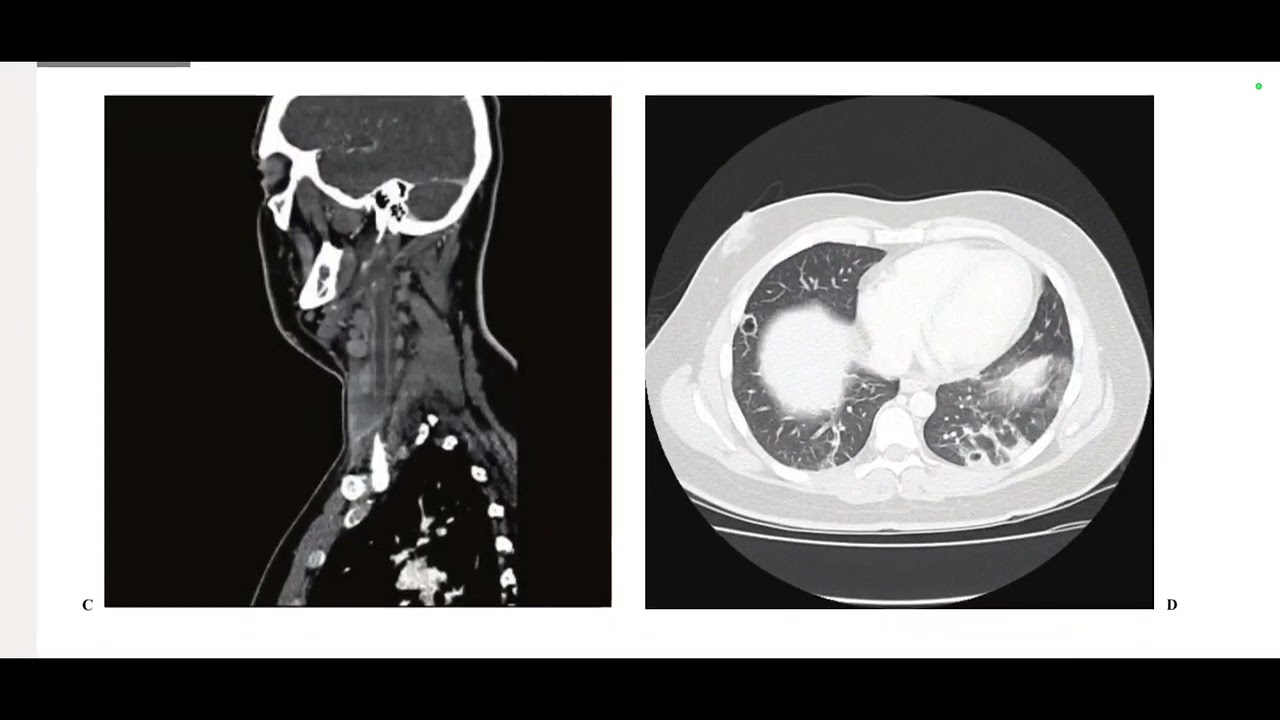 EMERGENCY RADIOLOGY RAD CASES THIEME FRCR BOOK(1) - YouTube