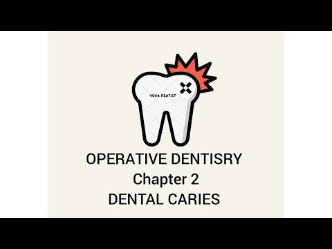 OPERATIVE DENTISRY CHAPTER 2 DENTAL CARIES PART 2 - YouTube