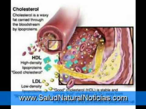 Lo que podría potencialmente causar una infección de riñón Parte 4 ...