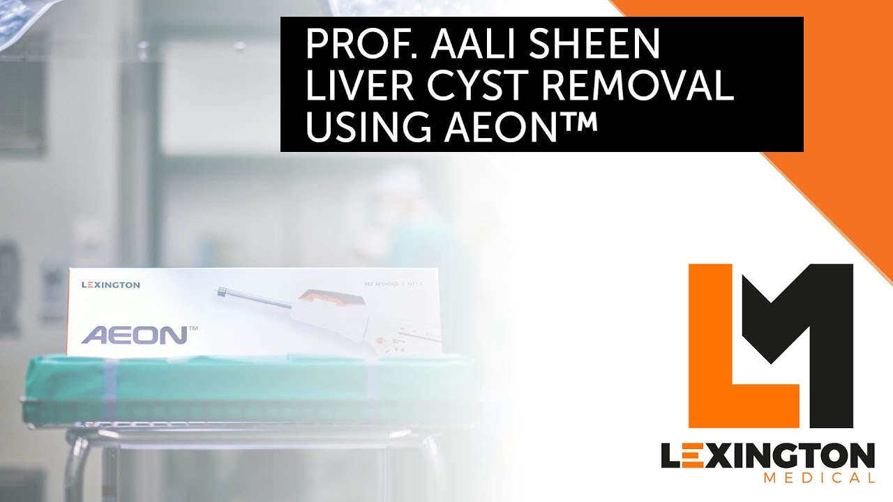 Prof Aali Sheen Liver Cyst Removal Using a Lexington Medical AEON ...