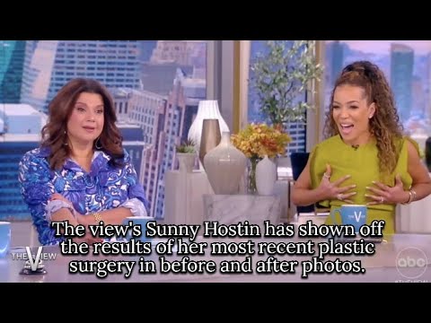 NEW VIEW The View’s Sunny Hostin shows off plastic surgery on her face ...
