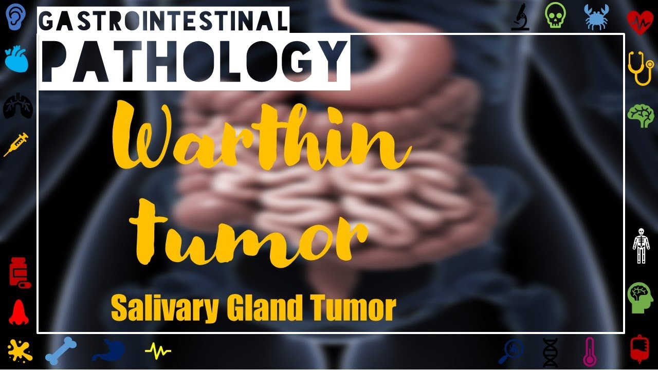 Warthin Tumor Pathology and Morphology|Salivary Gland Tumors|GI ...