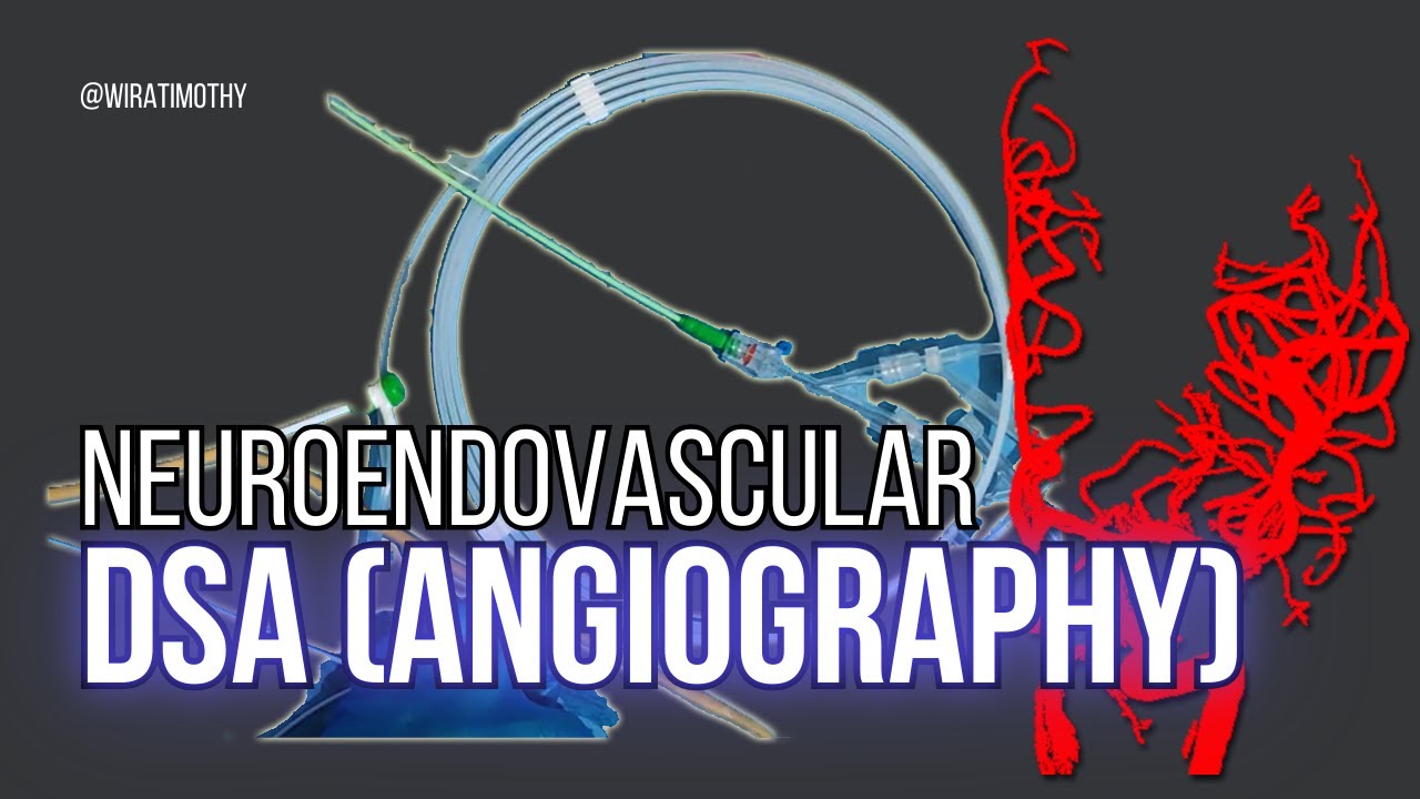 Brain Angiography (DSA) - Theory & Practice - YouTube