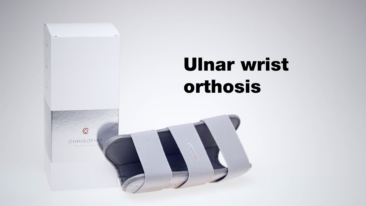 Chrisofix® Ulnar wrist orthosis - YouTube