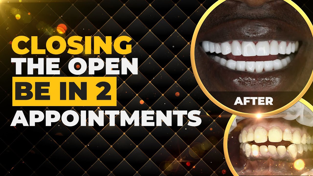 Watch This Amazing Transformation - YouTube