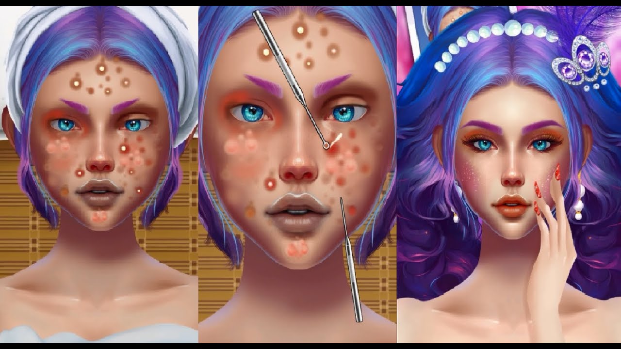 ASMR Removal of black putrefactive dots - on the face. - YouTube