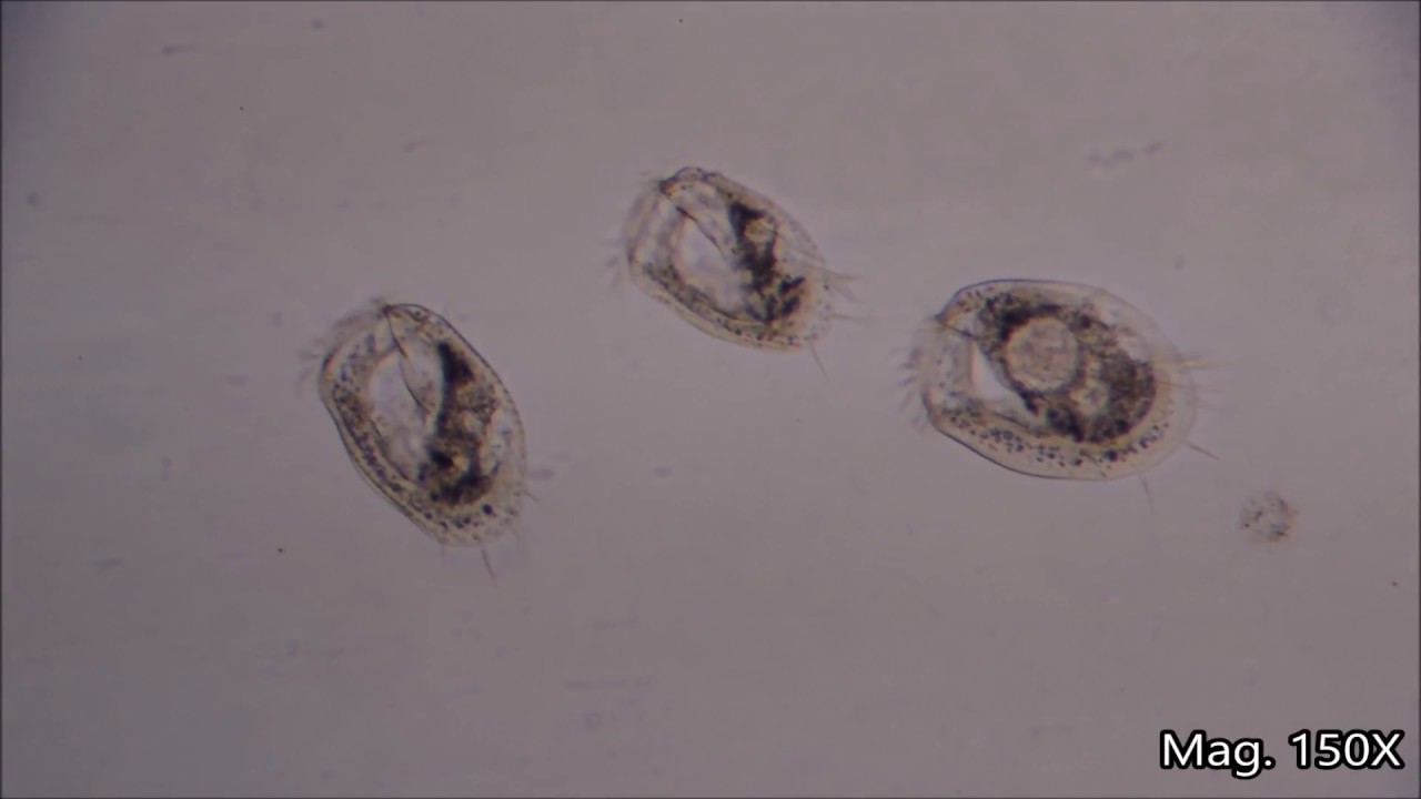 Euplotes Under Microscope