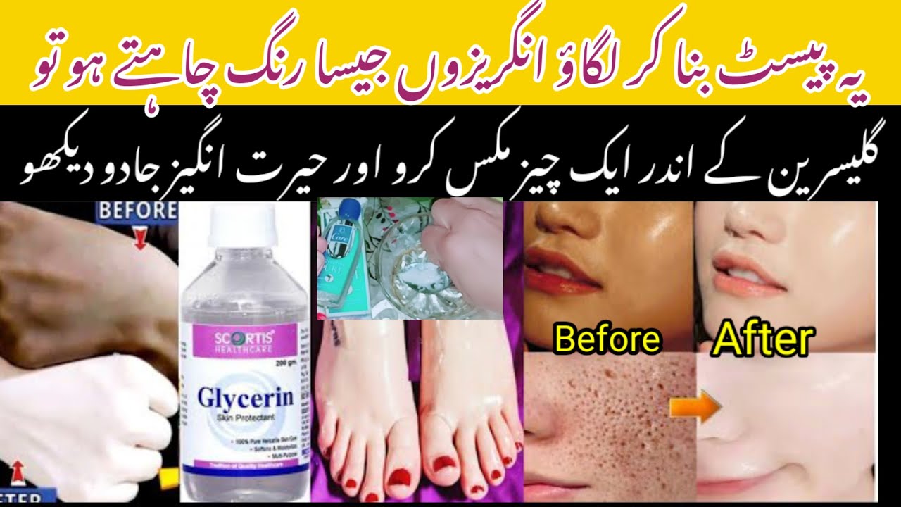 hands and foot whitening farmula with whitening Capsule || Glycerin for ...