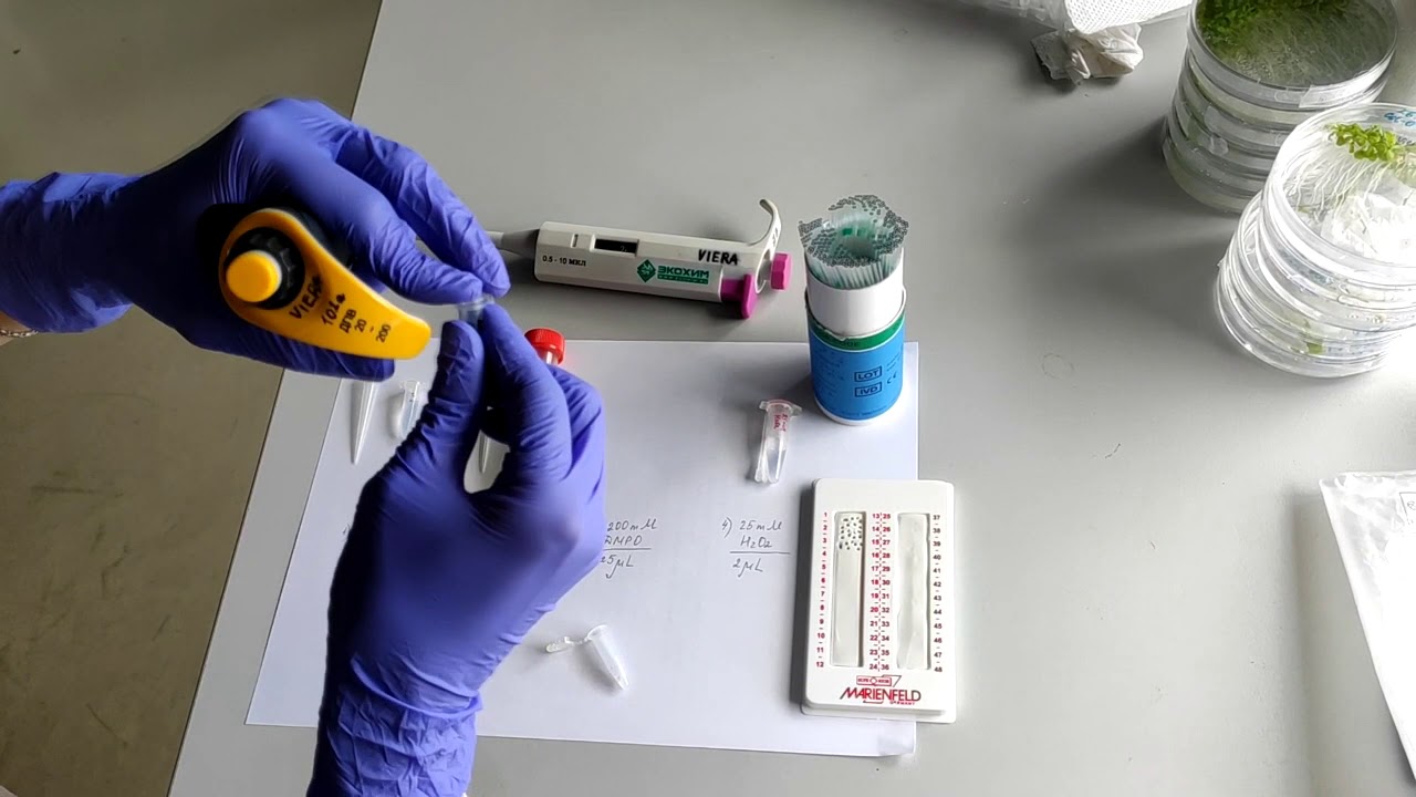 How to detect ROS using EPR-spectroscopy - YouTube