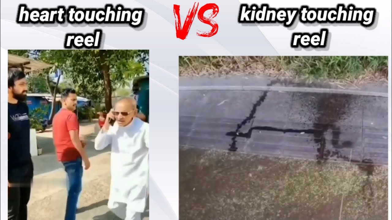 🅰🆁🆃 🆃🅾🆄🅲🅷🅸🅽🅶 🆁🅴🅴🅻 🆅🆂 🅺🅸🅳🅽🅴🆈 🆃🅾🆄🅲🅷🅸🅽🅶 🆁🅴🅴🅻 | heart touching reel vs ...