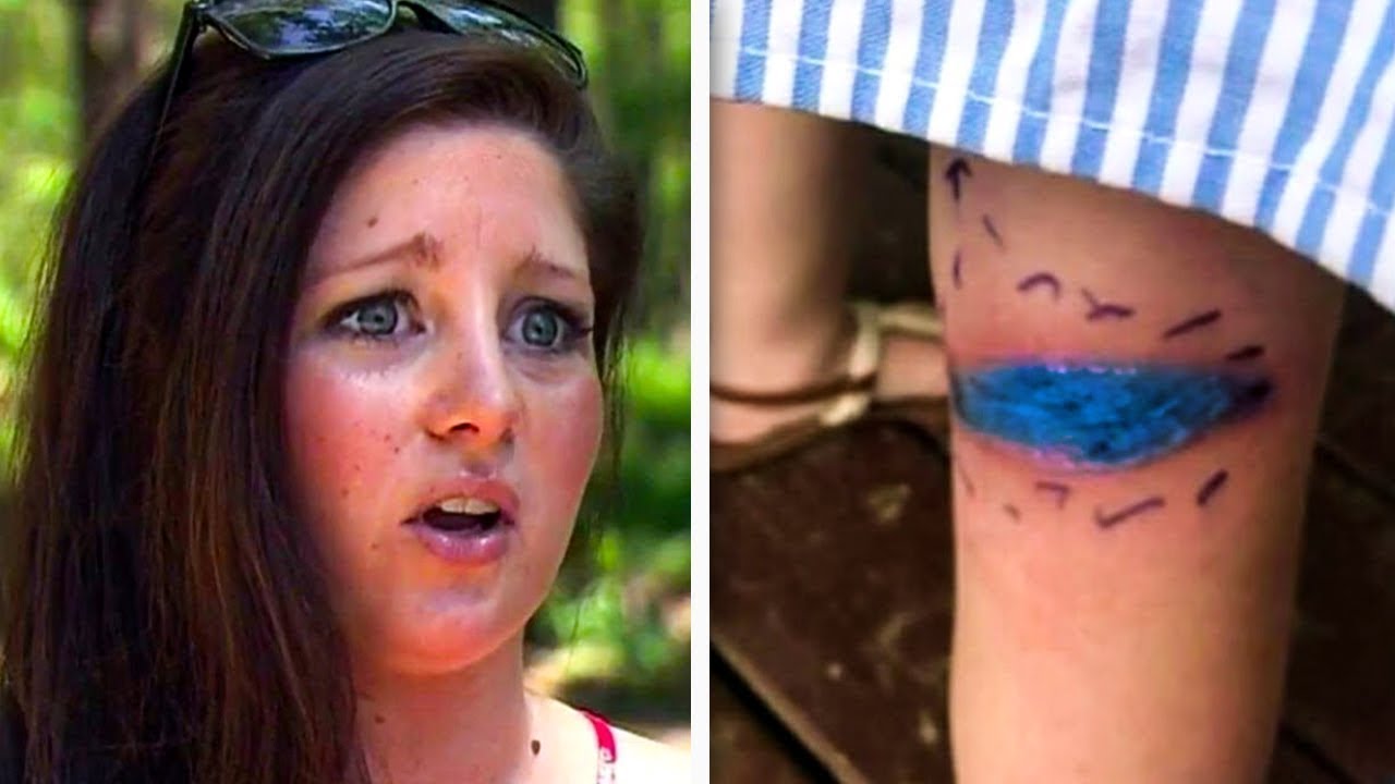 Mom Spots 'Blue Mark' On Her Daughter’s Leg – Rashes Her To Hospital ...