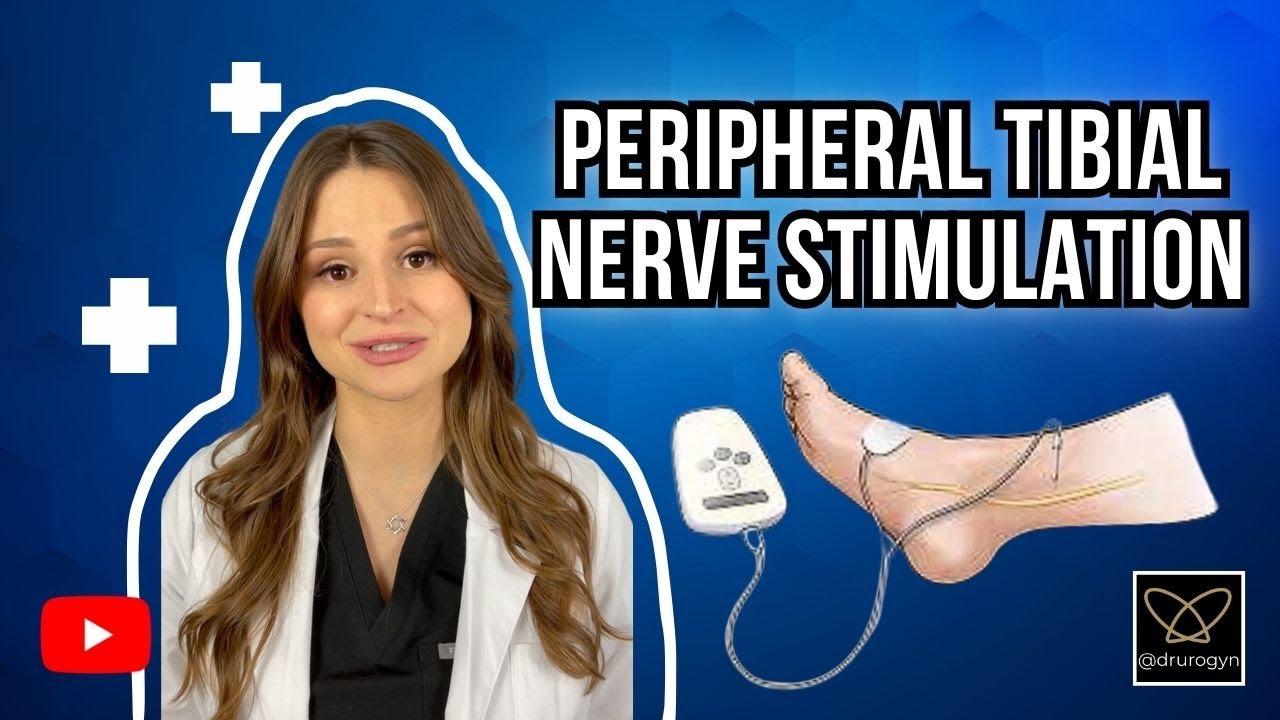 Peripheral Tibial Nerve Stimulation - YouTube