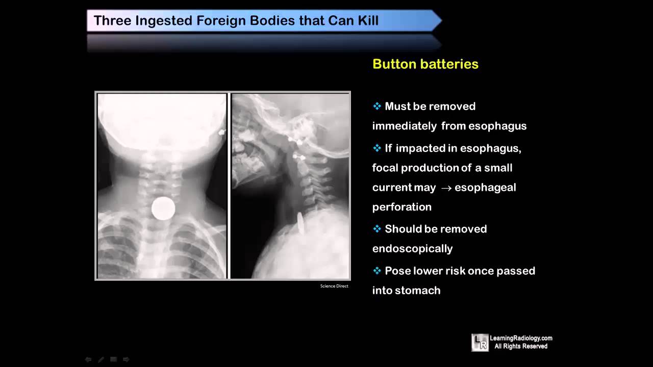 A LearningRadiology.com Top Ten Video - YouTube