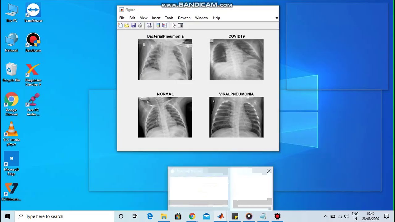 covid 19 xray image classification by convolution neural network (CNN ...