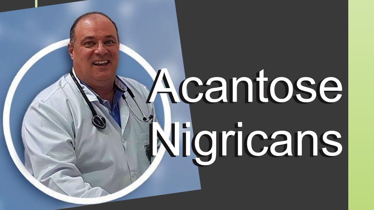 Acantose nigricans - YouTube
