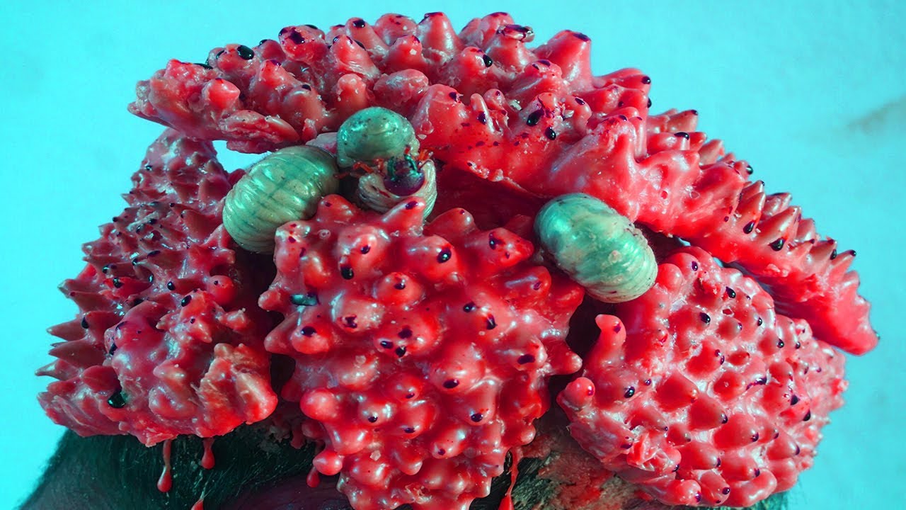 OH No No!! What a big Flake? Dandruff Scratching King Worm And King ...