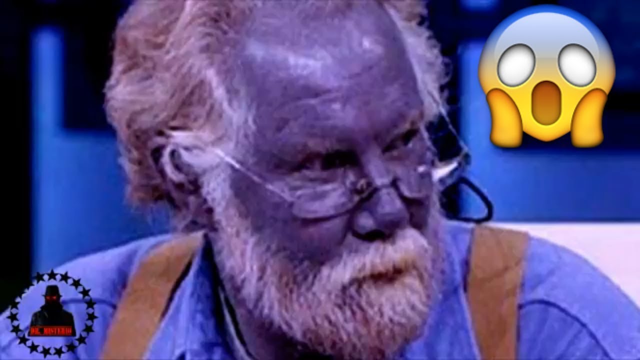 ESSE HOMEM FICOU AZUL E PODE ACONTECER COM VOCÊ - YouTube