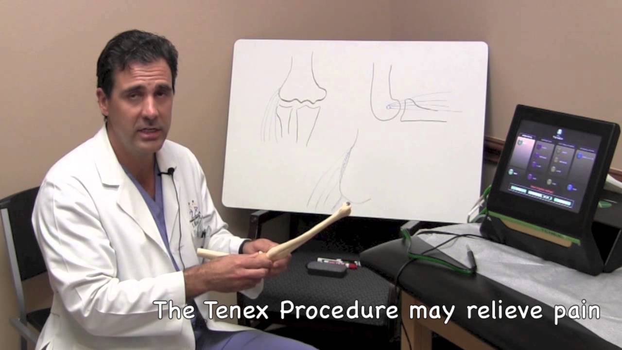 Introduction to the Tenex Tennis Elbow Procedure - Dr. J. Michael ...