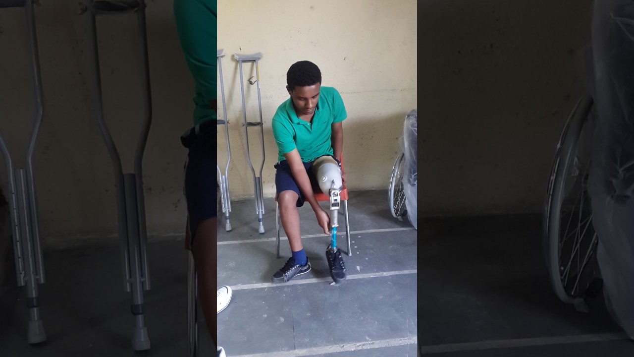 AK Prosthesis with Knee Rotator fitted at PROACTIVE Technical ...