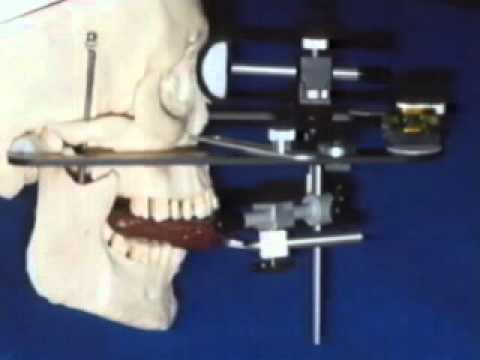 Kois System- Introduction by Panadent - YouTube