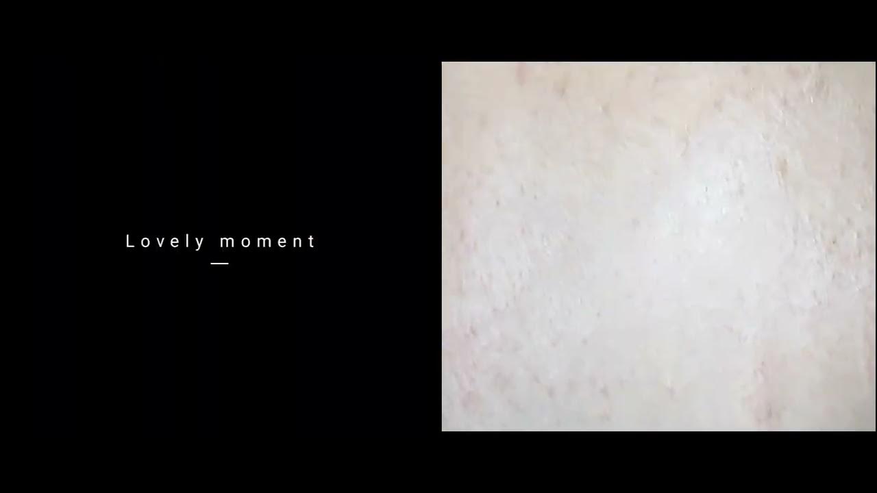 шугаринг после процедуры - YouTube