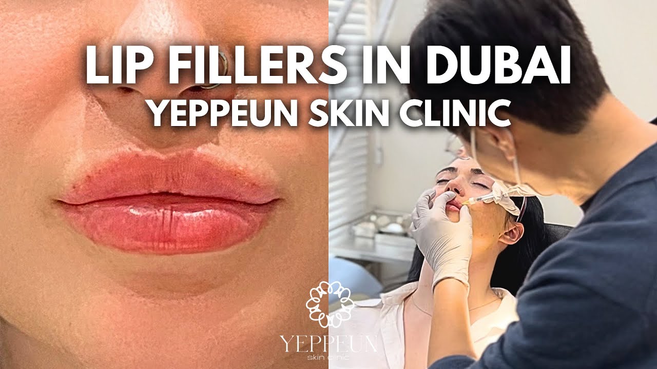 Lip Fillers in Dubai | Yeppeun Skin Clinic #Dubai #Dubaibeauty #Kbeauty ...
