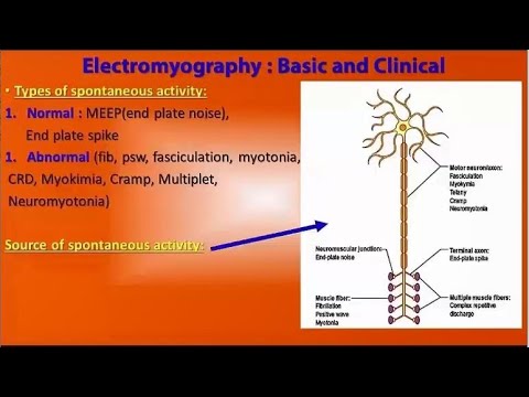 What is the Spontaneous Activity, its importance, and its origins in ...