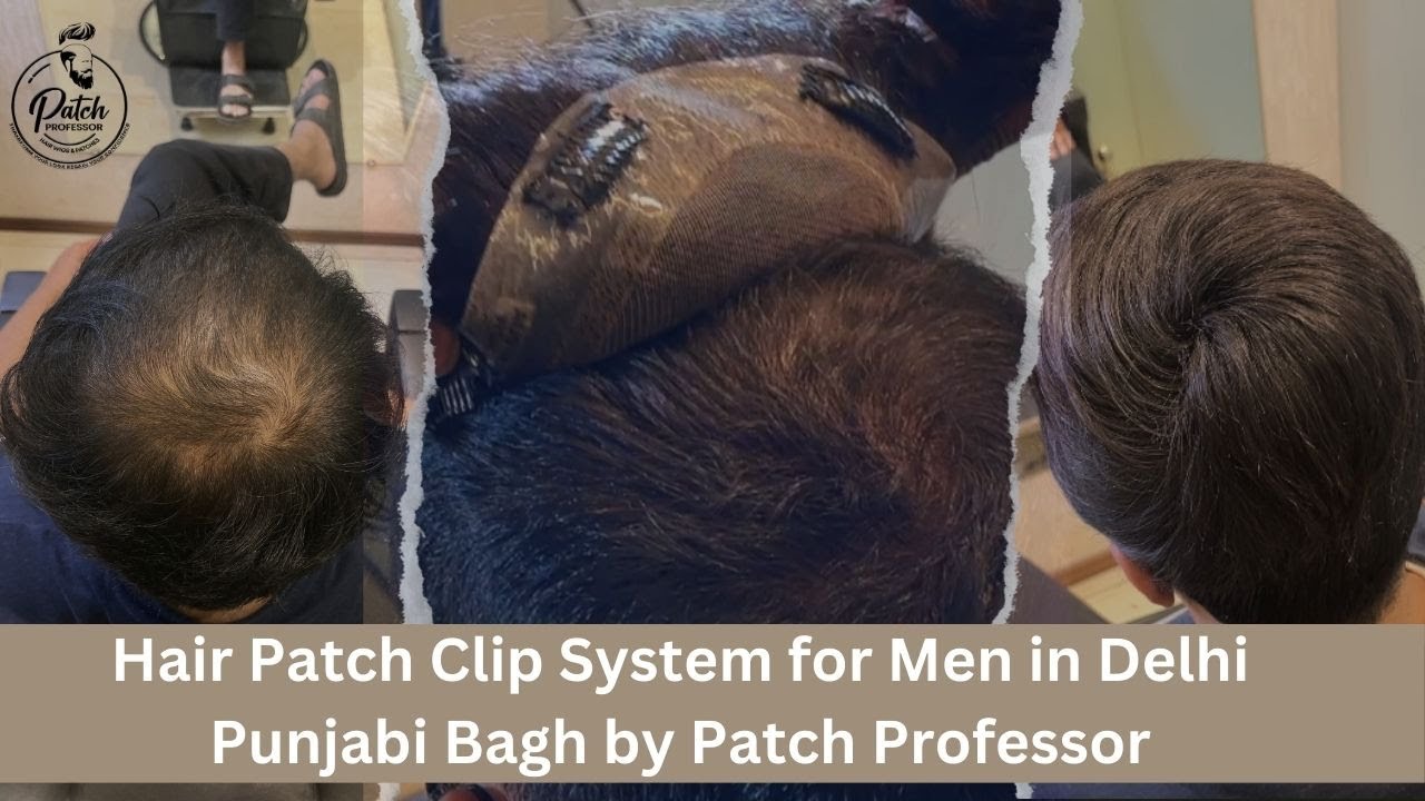 clipping method hair patch fixing | Hair Patch Clip System for Men in ...