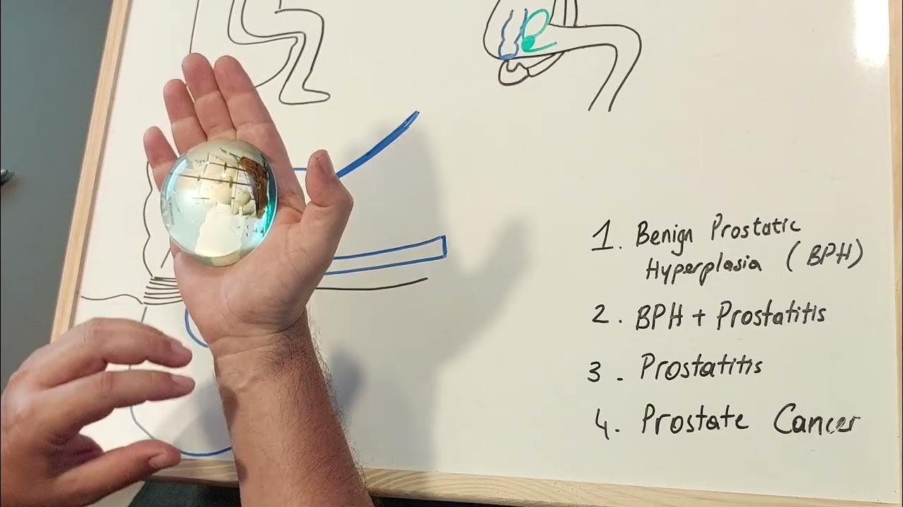 Self Prostate Massage Examination For Men Over 60 Youtube