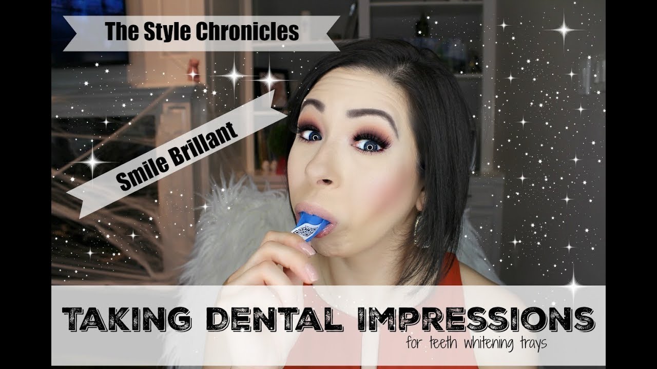 Taking Dental Impressions for Teeth Whitening Trays - Smile Brilliant ...