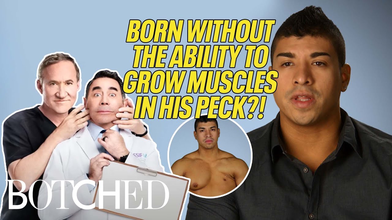 Body Builder Albert Can Only Grow Muscle In His Right Peck?! (Before ...