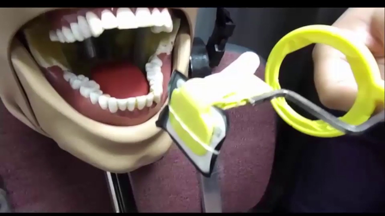 Posterior Periapical Mandibular Placement - YouTube