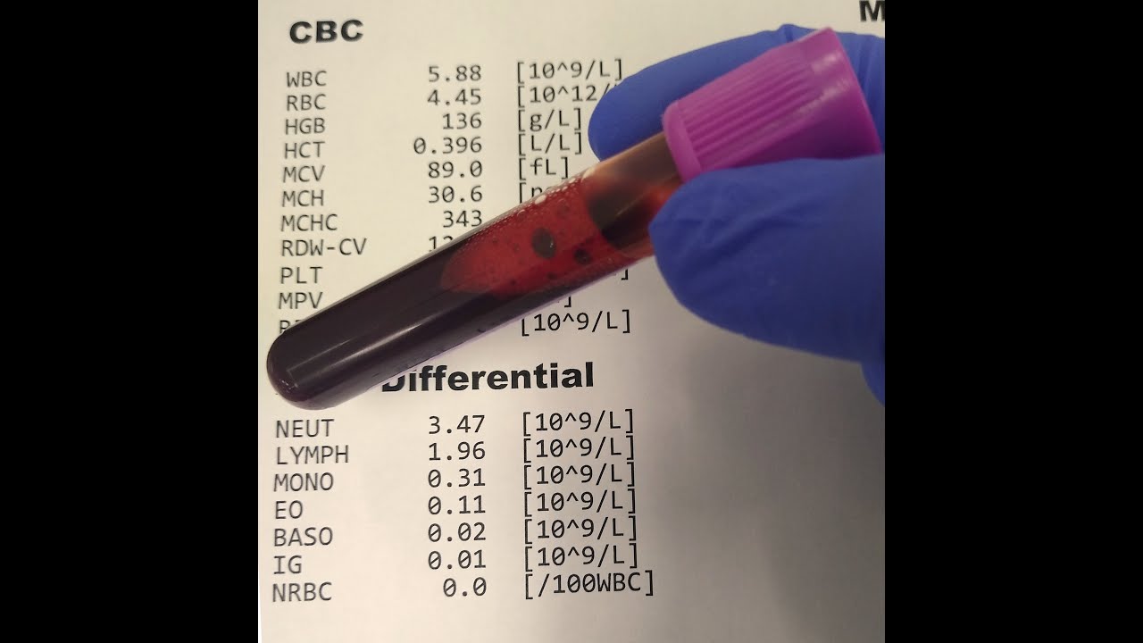 CBC Approach - YouTube