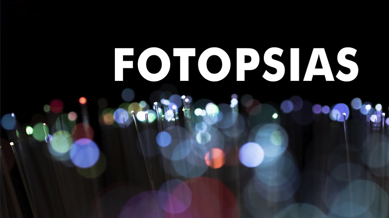 Fotopsias Dres. Alberto Castro, Ana Milena Bautista y Camila León 8 ...