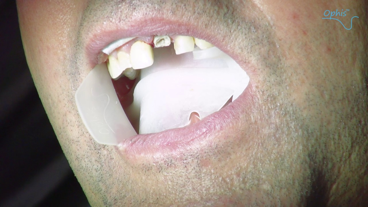 Repose tenon et couronne sur une 21 - YouTube